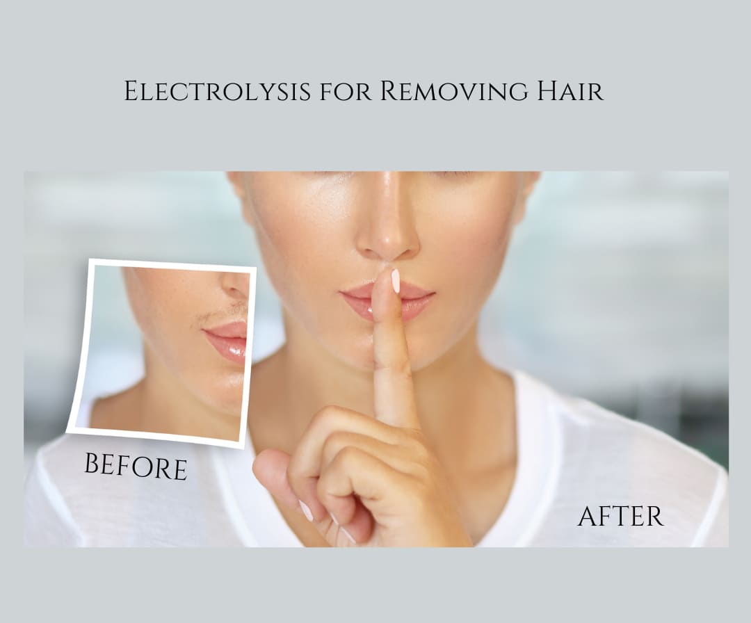 Electrolysis – Laser and Organic Spa